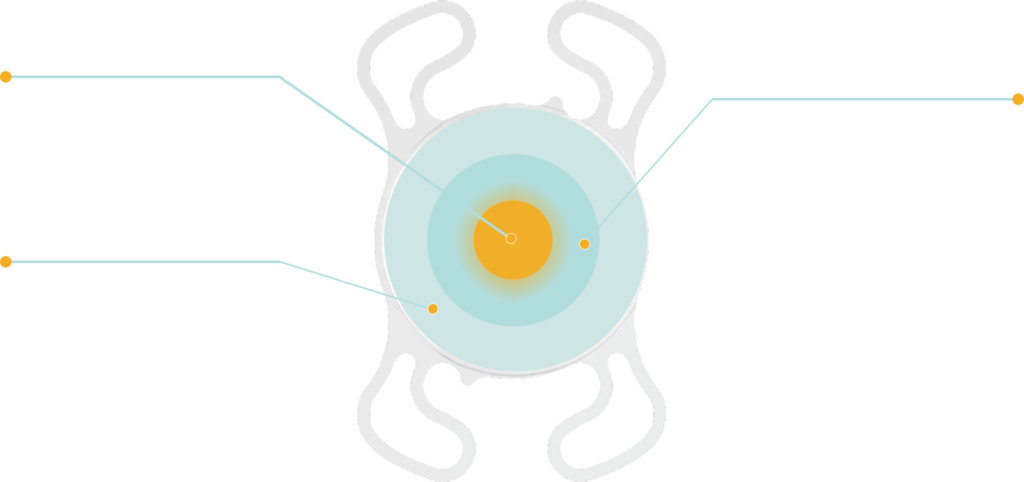 Premium Preloaded Intraocular Lens | LuxSmart™ by Bausch + Lomb