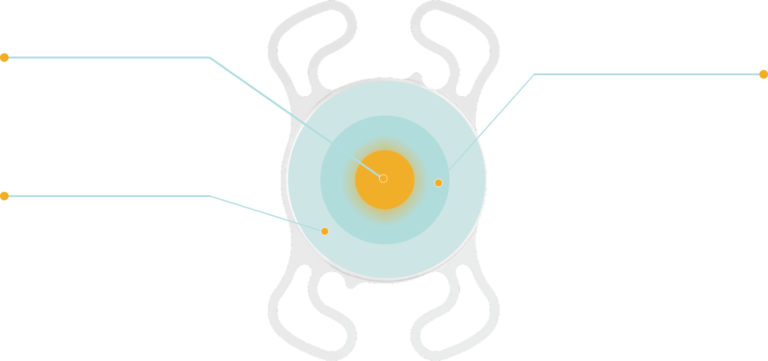 Premium Preloaded Intraocular Lens | LuxSmart™ by Bausch + Lomb