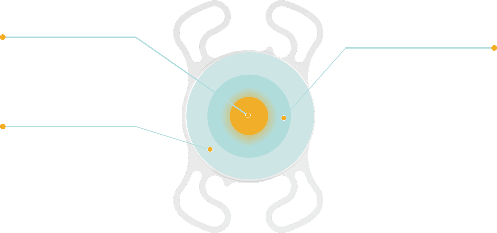 Premium Preloaded Intraocular Lens | LuxSmart™ by Bausch + Lomb
